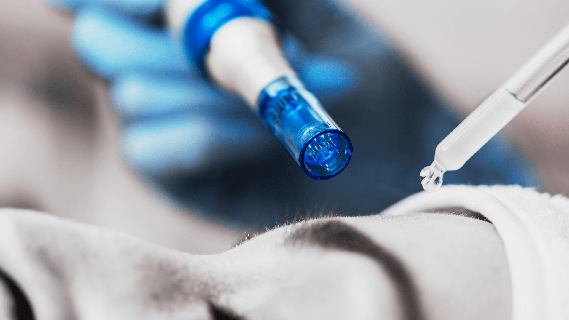 What Is a Vampire Facial? - Younique Surgery Center & Medical Spa